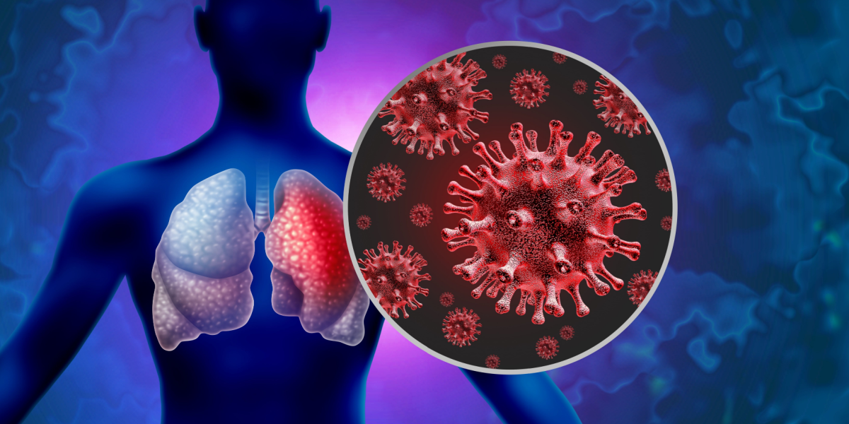 Skal vi være bekymrede? SSI melder om smitte på "epidemisk niveau"